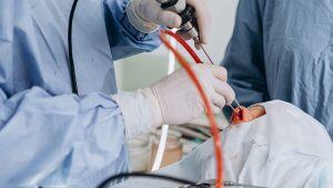 GI endoscopy - 3-D Matrix